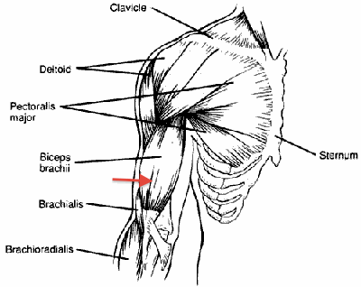 Pain in muscle above right elbow - General Discussion - Neowin